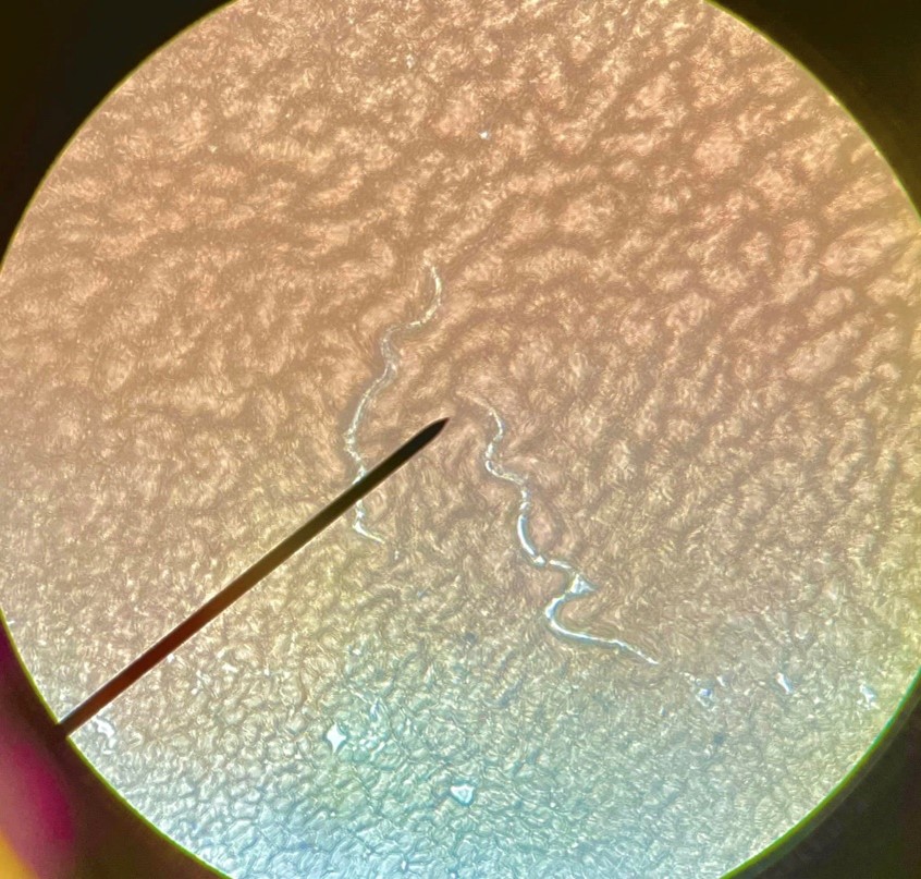 Heartworm in your pet? See a cardiologist! - Boundary Bay Veterinary ...